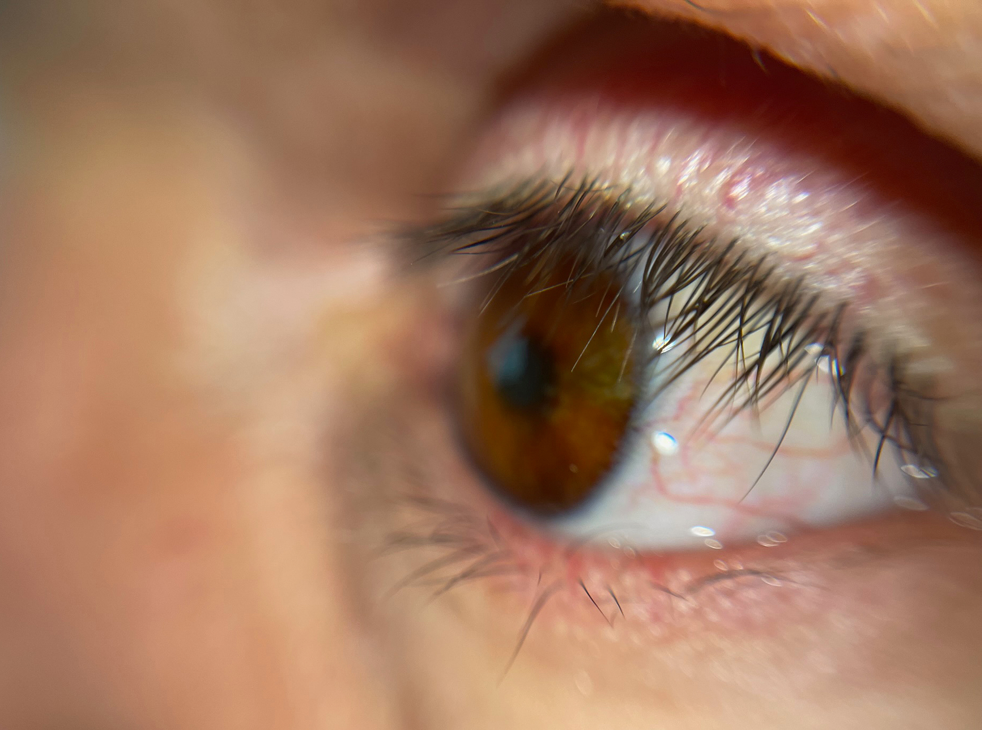 Kickstart: The (3D printed) eyes have it | Plastics News